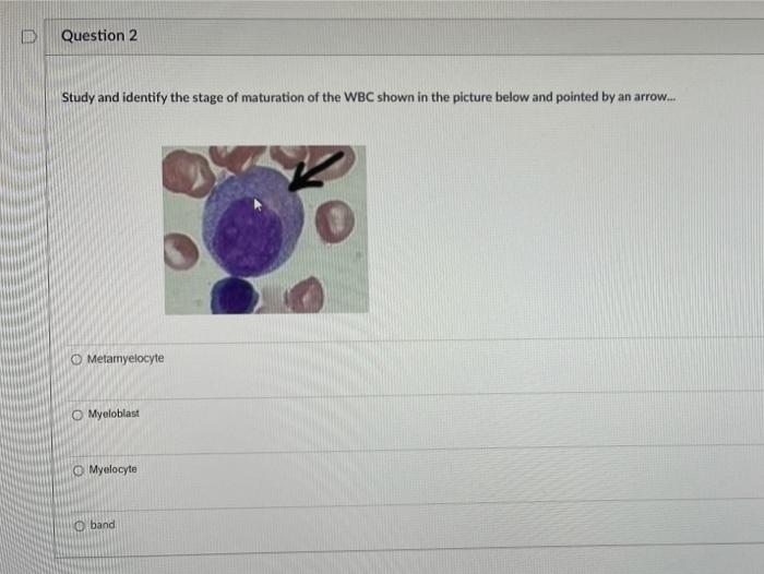 Solved Question 2 Study and identify the stage of maturation | Chegg.com