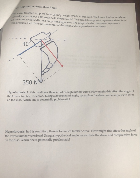Solved Application: Sacral Base Angle sacral foramen | Chegg.com