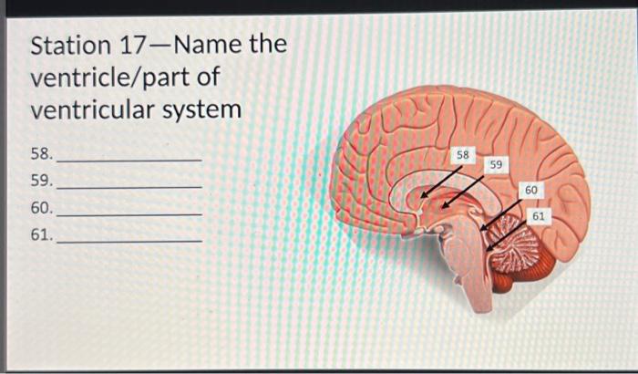 Solved Station 17-Name the ventricle/part of ventricular | Chegg.com