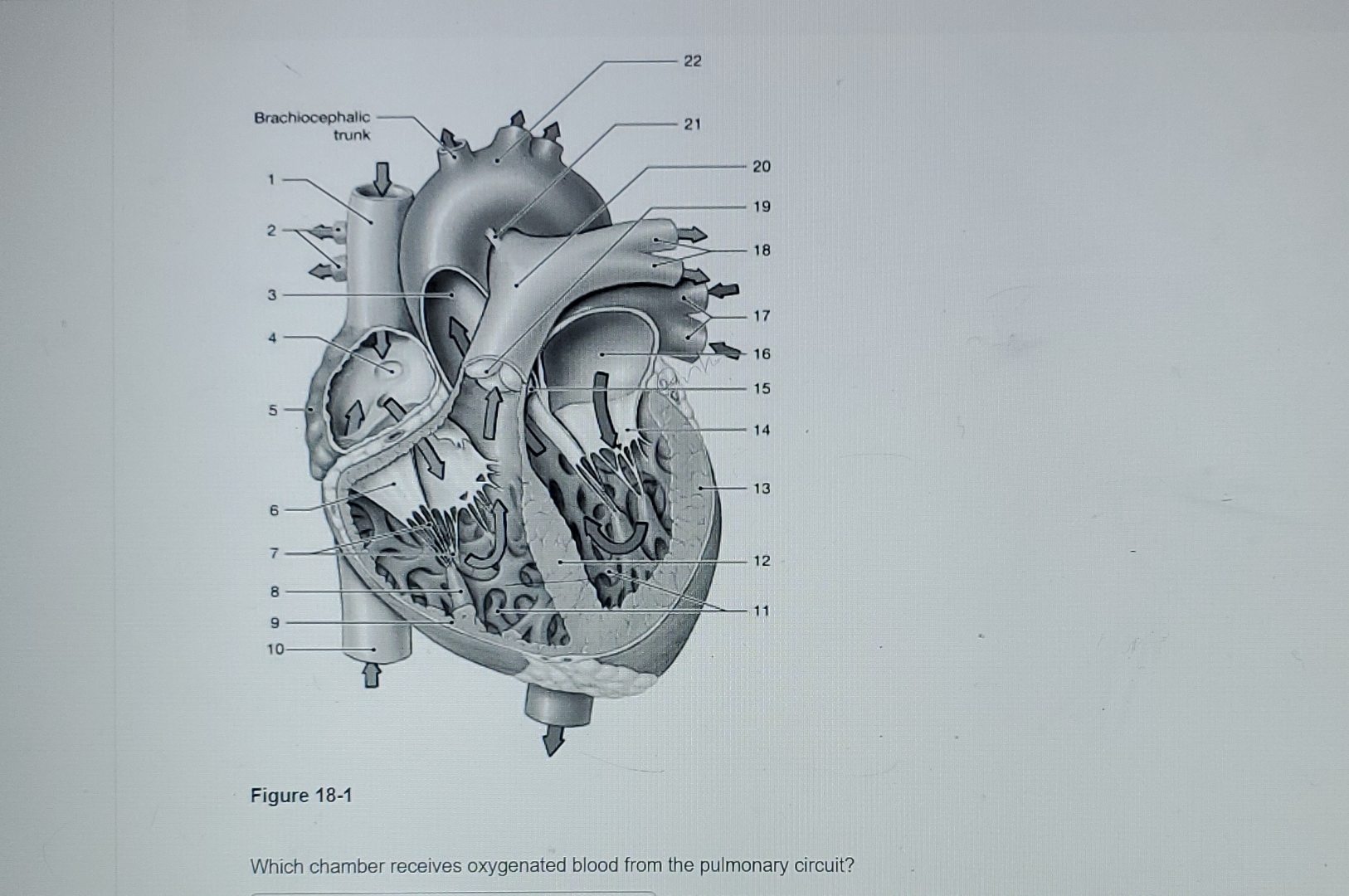 Solved Figure 18-1Which chamber receives oxygenated blood | Chegg.com