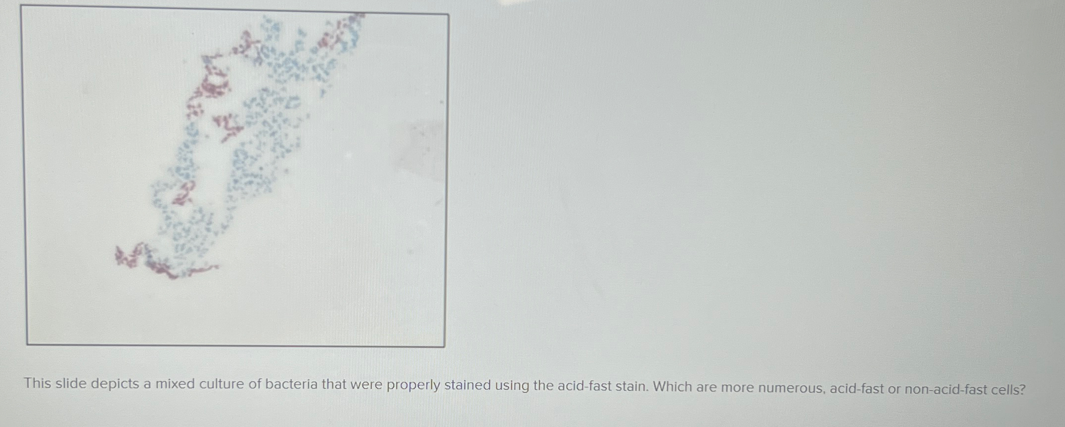Solved This slide depicts a mixed culture of bacteria that | Chegg.com