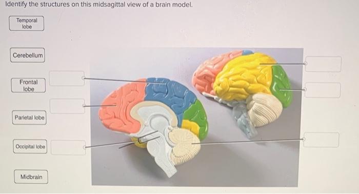 Solved Identify the structures on this midsagittal view of a | Chegg.com