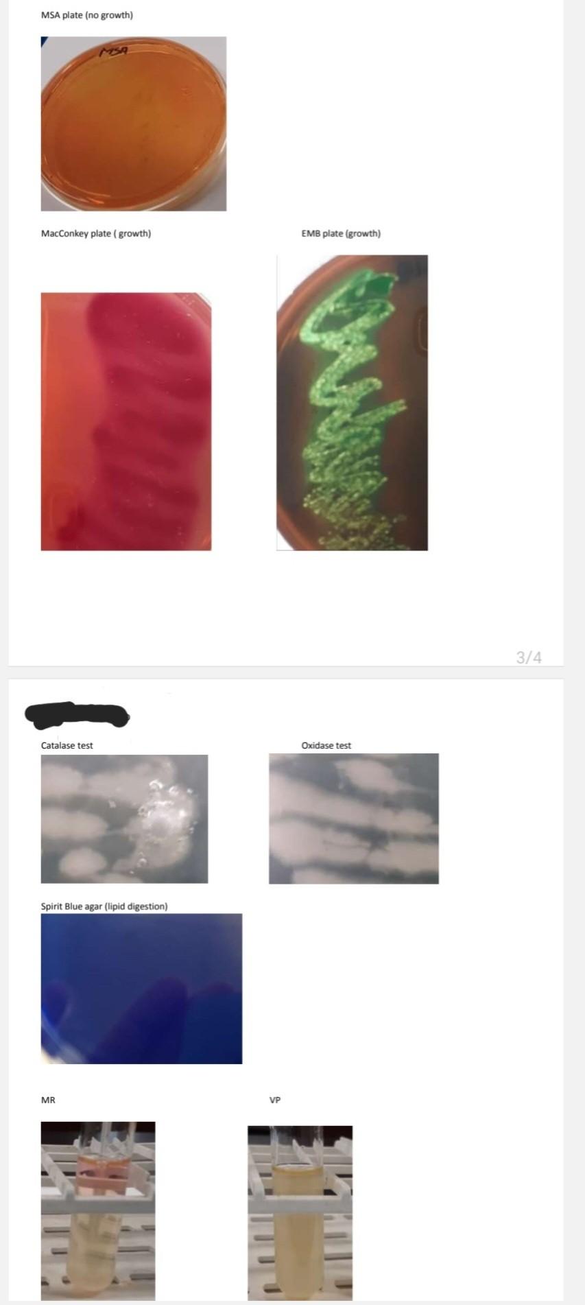 MSA plate (no growth) SA MacConkey plate (growth) EMB | Chegg.com