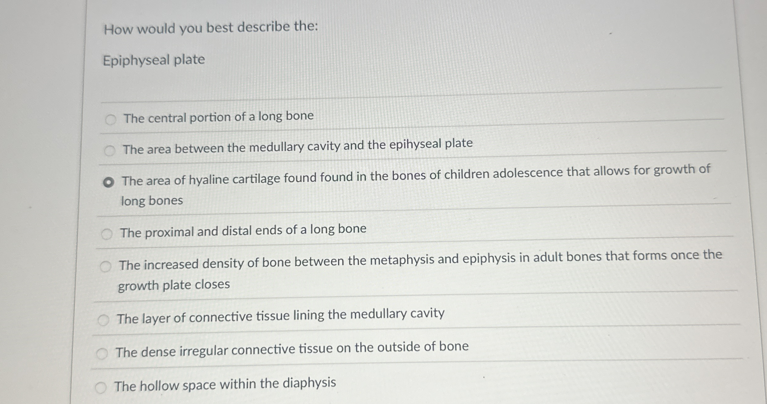 [Solved]: How would you best describe the: Epiphyseal plate