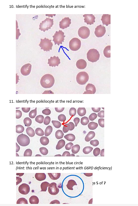 Solved 10. ﻿Identify the poikilocyte at the blue arrow:11. | Chegg.com