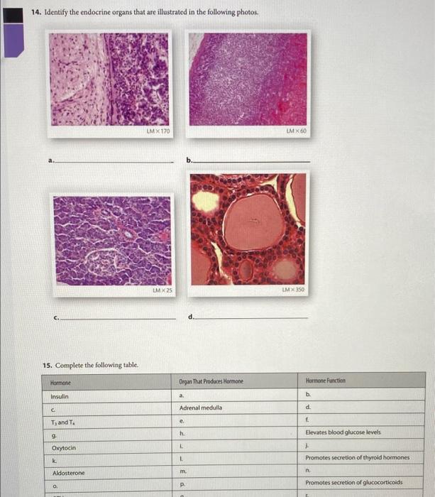Solved 14. Identify the endocrine organs that are | Chegg.com