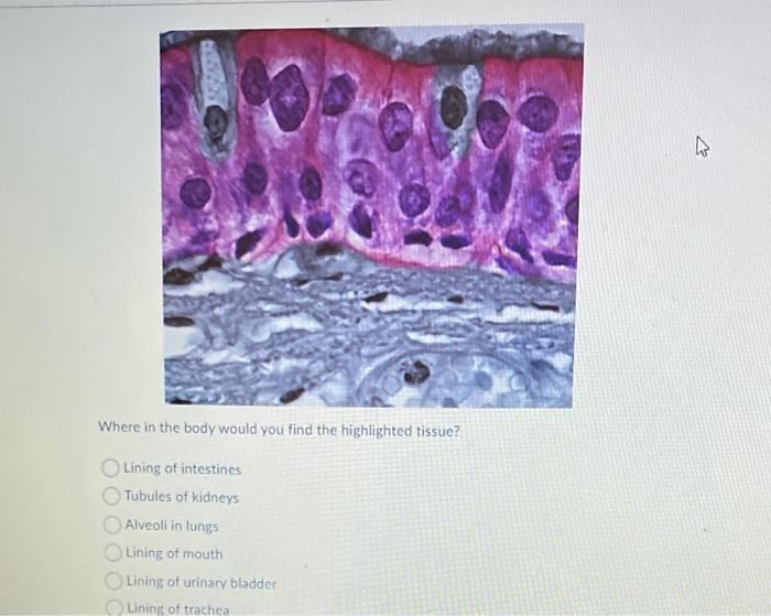 Solved Identify the highlighted tissue type 5: | Chegg.com