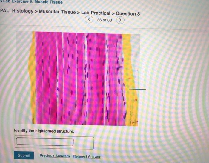Solved Lab Exercise 9: Muscle tissue PAL: Histology > | Chegg.com Solved Lab Exercise 9: Muscle tissue PAL: Histology > | Chegg.com