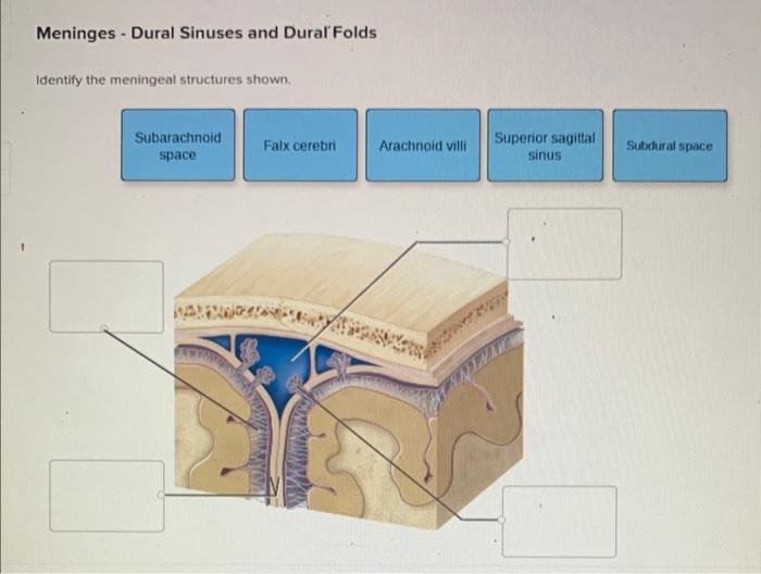 Solved Meninges - Dural Sinuses and Dural Folds | Chegg.com