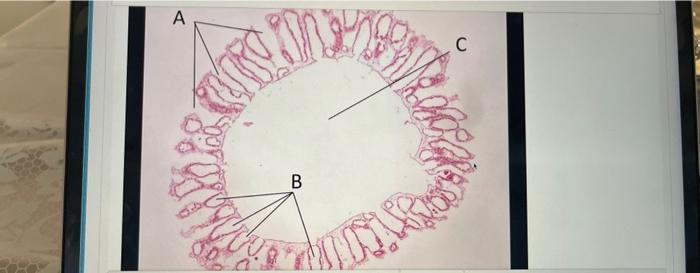 Solved A B C The slide shows a cross section of a sponge | Chegg.com