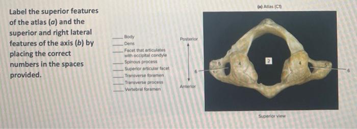 Solved Label the superior features of the atlas (a) and the | Chegg.com