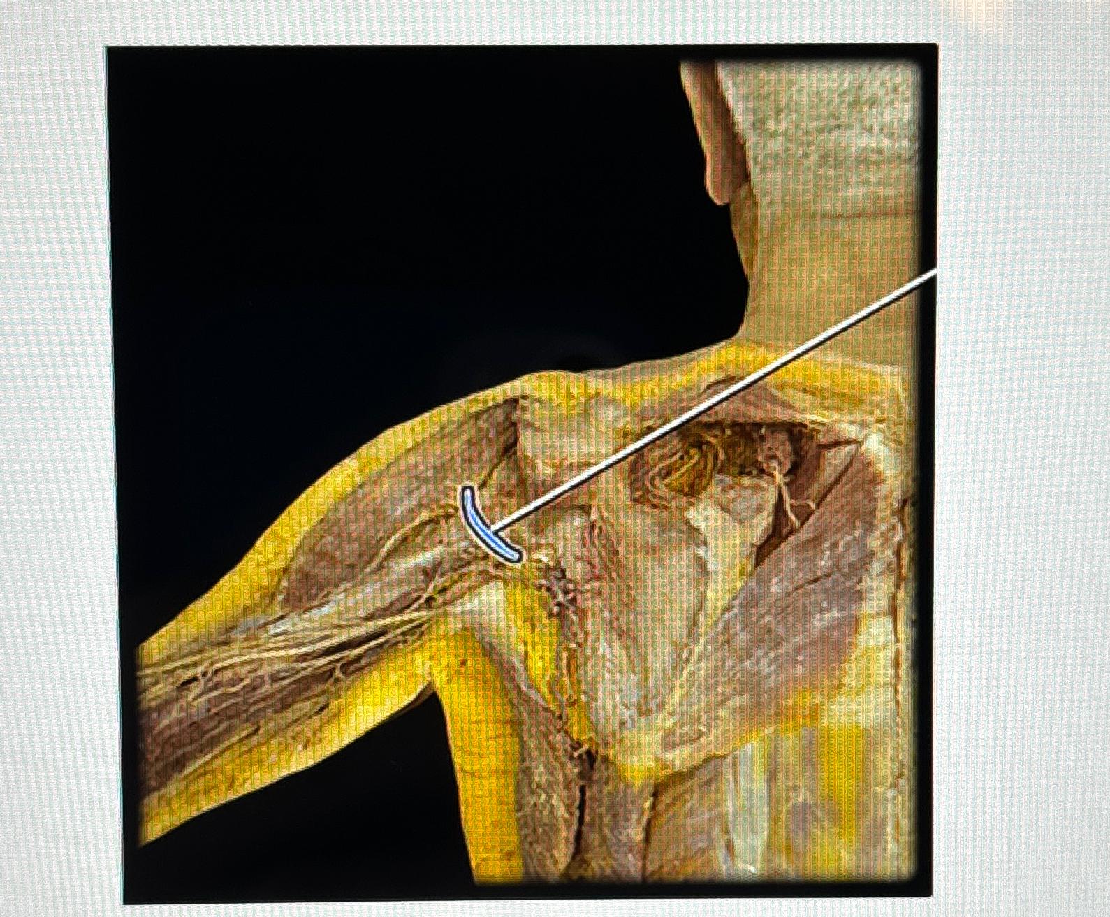 Solved Which structure is highlighted and indicated by the | Chegg.com