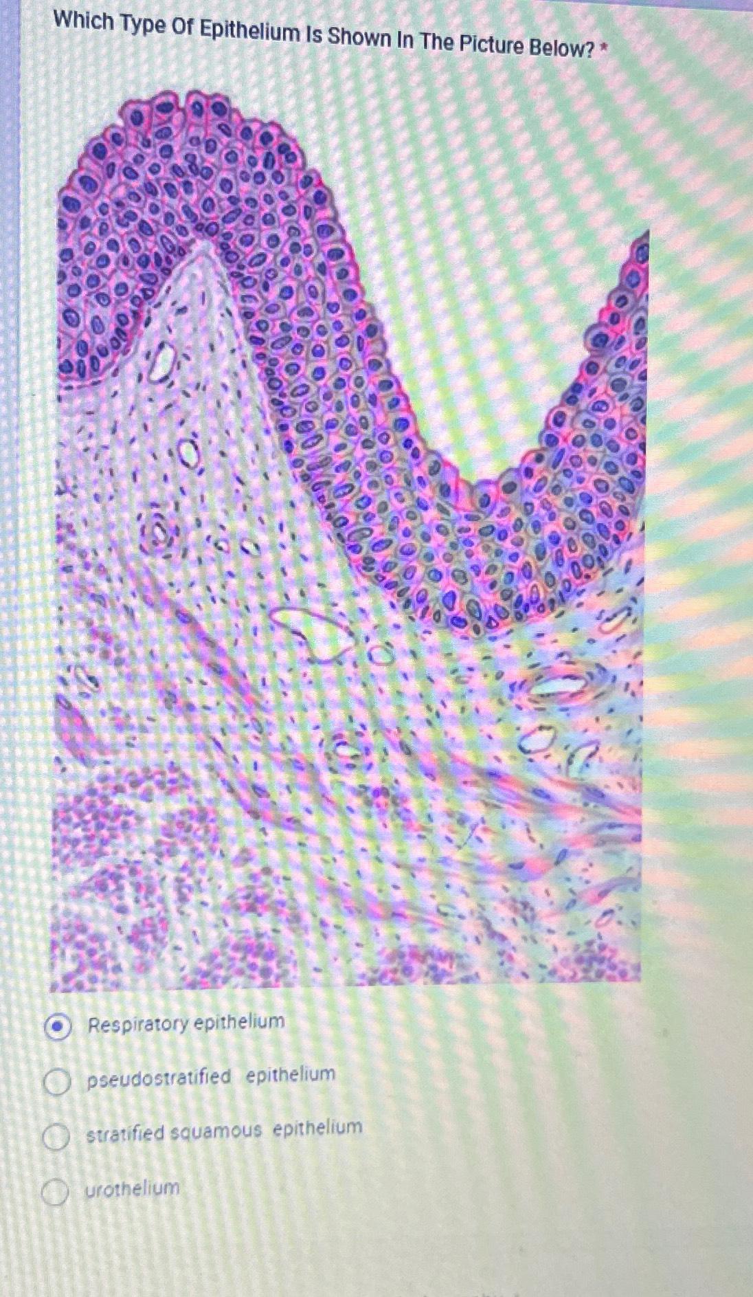 Solved Which Type of Epithelium Is Shown In The Picture | Chegg.com