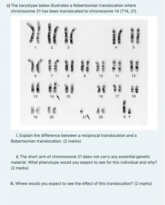 Solved a) What is the abnormality? (e.g. monosomy 14) b) | Chegg.com