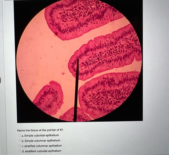 Solved Where in the body we find this tissue at the pointer | Chegg.com