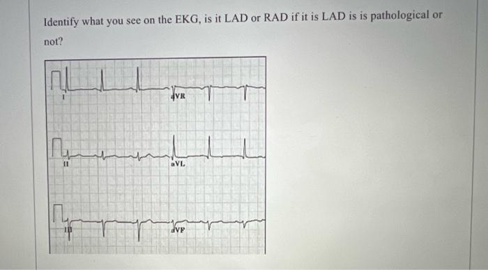 Solved Identify what you see on the EKG, is it LAD or RAD if | Chegg.com