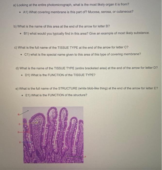 Solved a) Looking at the entire photomicrograph, what is the | Chegg.com