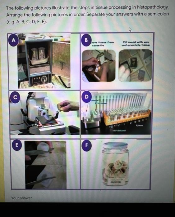 Solved The following pictures illustrate the steps in tissue | Chegg.com