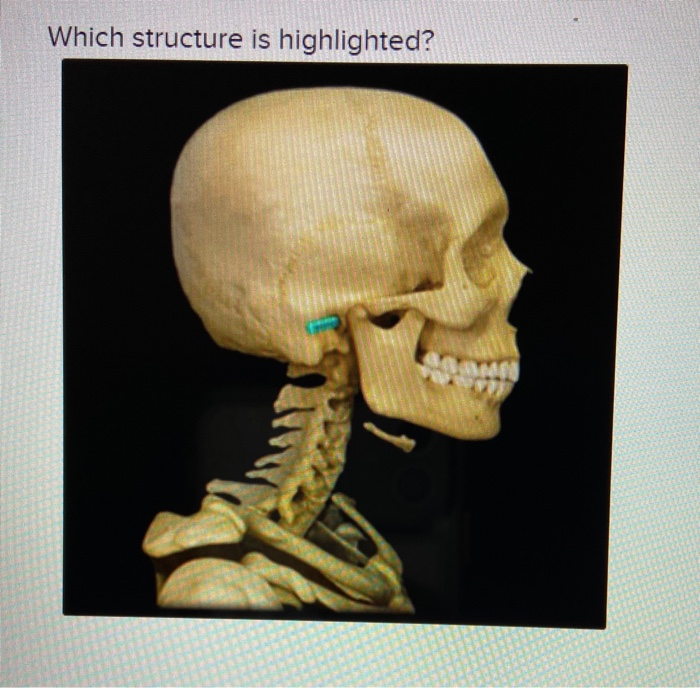 Solved Which structure is highlighted? MO stem... Multiple | Chegg.com