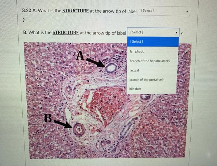 Solved 3.20 A. What is the STRUCTURE at the arrow tip of | Chegg.com