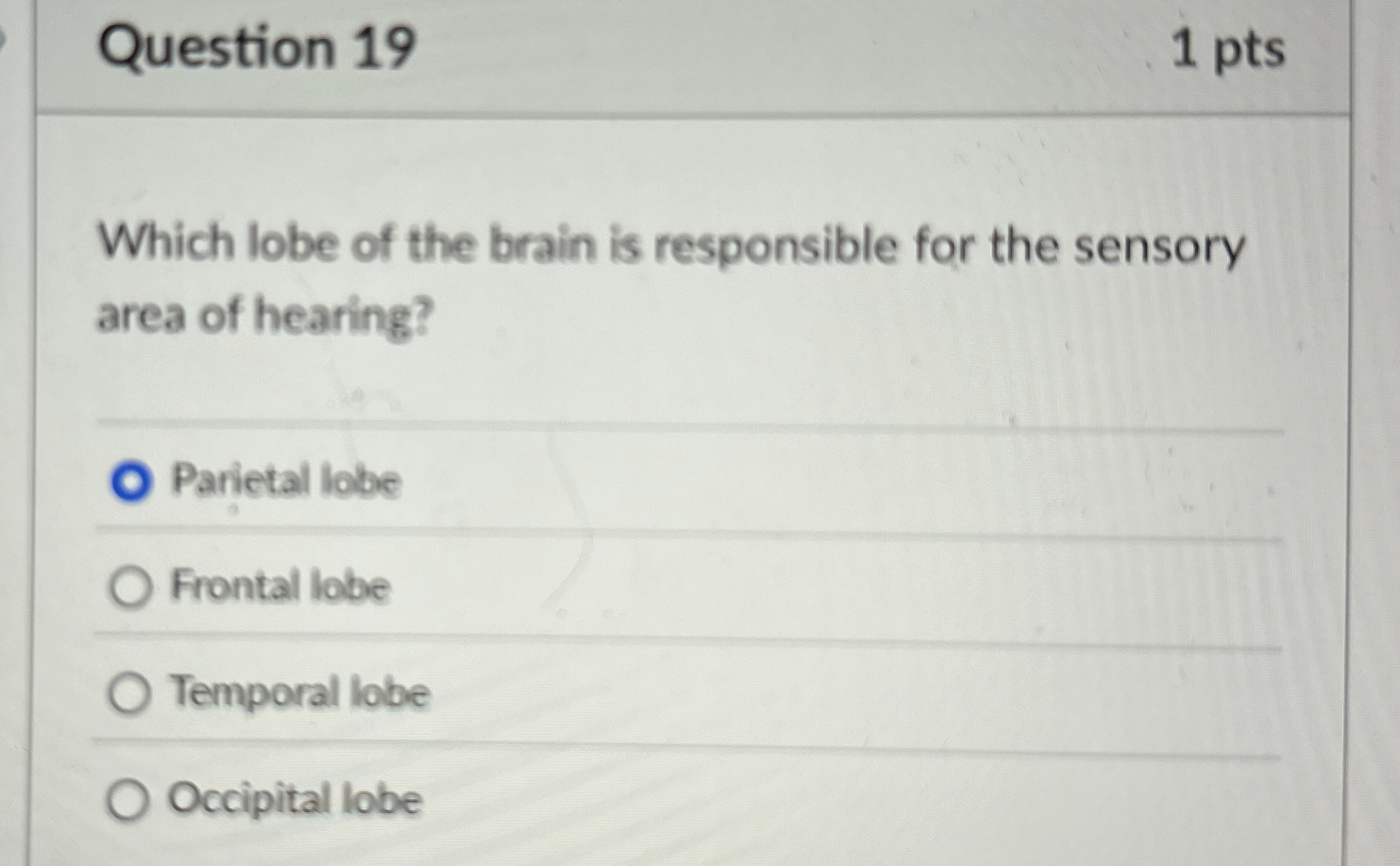 Solved Question 191 ptsWhich lobe of the brain is | Chegg.com Solved Question 191 ptsWhich lobe of the brain is | Chegg.com