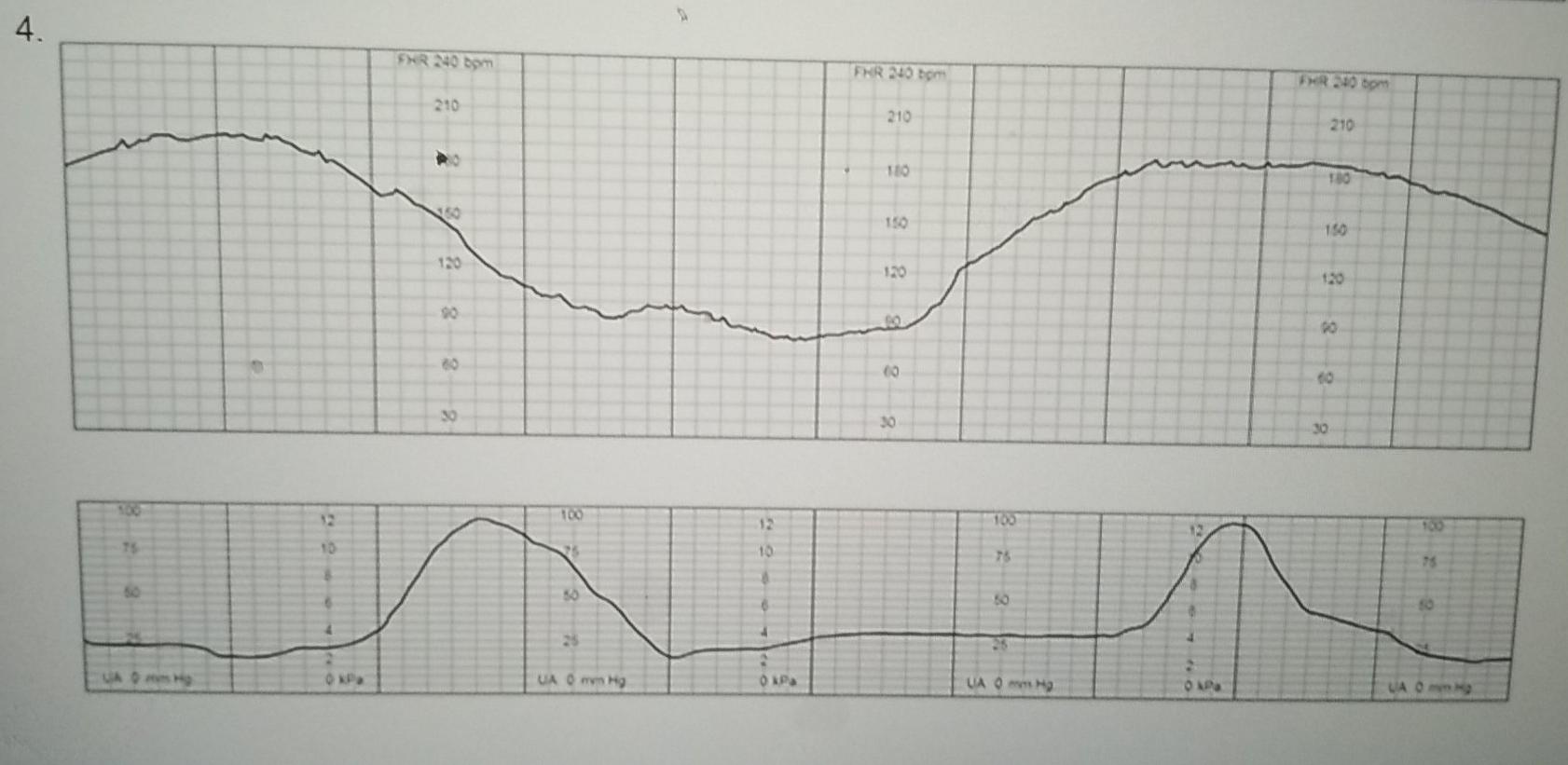 Solved e is caring for a client at 37 weeks gestation who is | Chegg.com