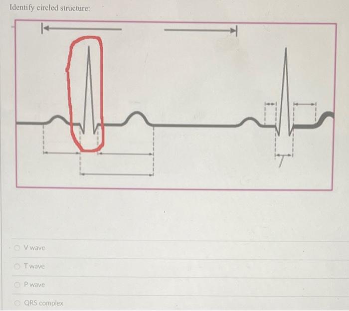 Solved Identify circled structure: V wave Twave P wave QRS | Chegg.com