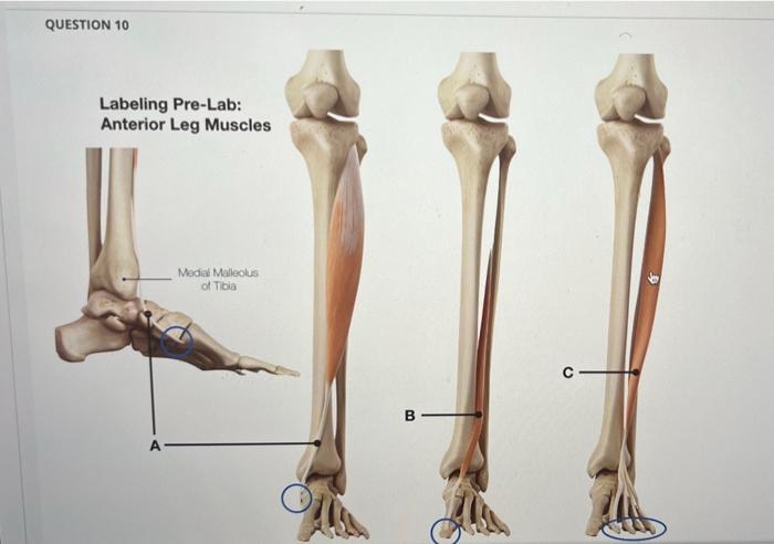 Solved QUESTION 10 Labeling Pre-Lab: Anterior Leg Muscles | Chegg.com