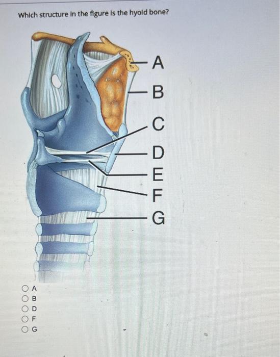 Solved Which structure in the figure is the hyoid bone? | Chegg.com