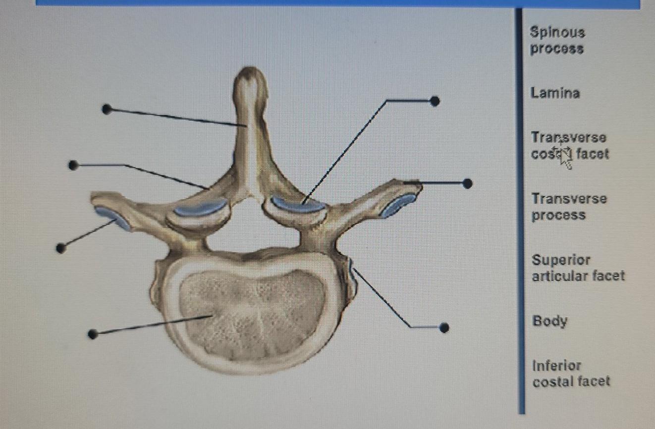 Solved Spinous proc933 Lamina Transverse cost facet | Chegg.com