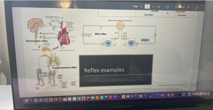 diagram the refiex pathways described. Be as specific | Chegg.com