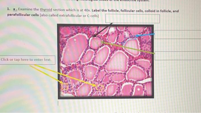 Follicular Colloid Of Thyroid