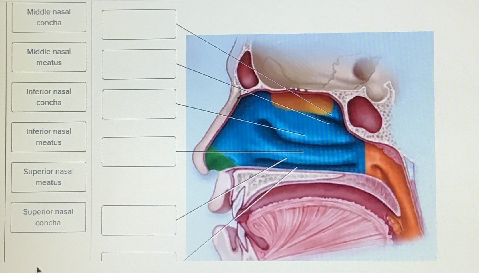 Solved Anatomical structures of the upper respiratory tract | Chegg.com