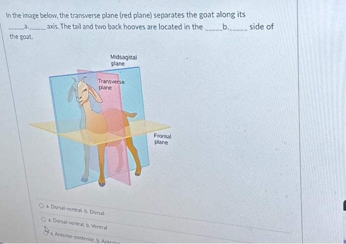 Solved In the image below, the transverse plane (red plane) | Chegg.com