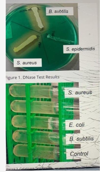 Solved B. subtilis S. epidermidis S. aureus Figure 1. DNase | Chegg.com