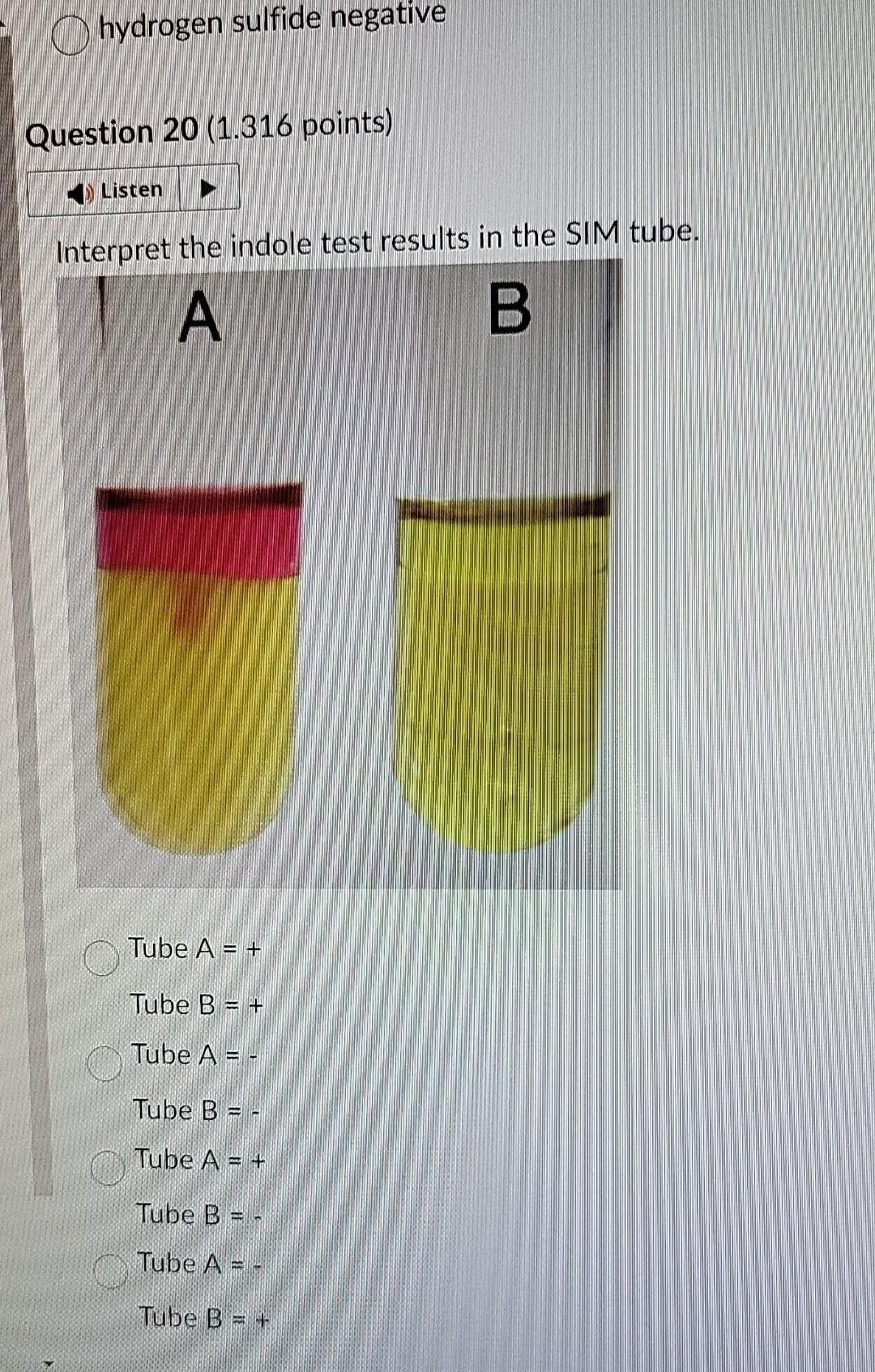 Solved Interpret the results of the Ornithine decarboxylase | Chegg.com