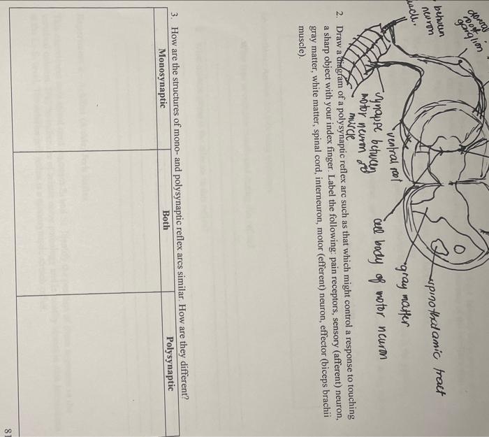 a sharp object with your index finger. Label the | Chegg.com
