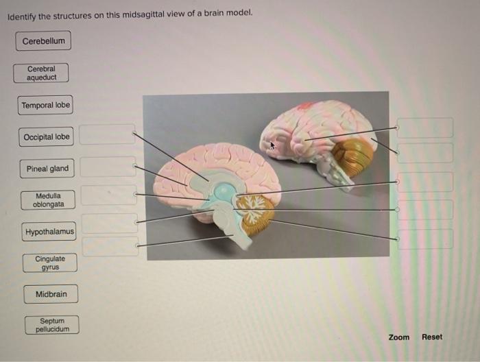 Identify The Structures On This Midsagittal View Of A - vrogue.co Identify The Structures On This Midsagittal View Of A - vrogue.co