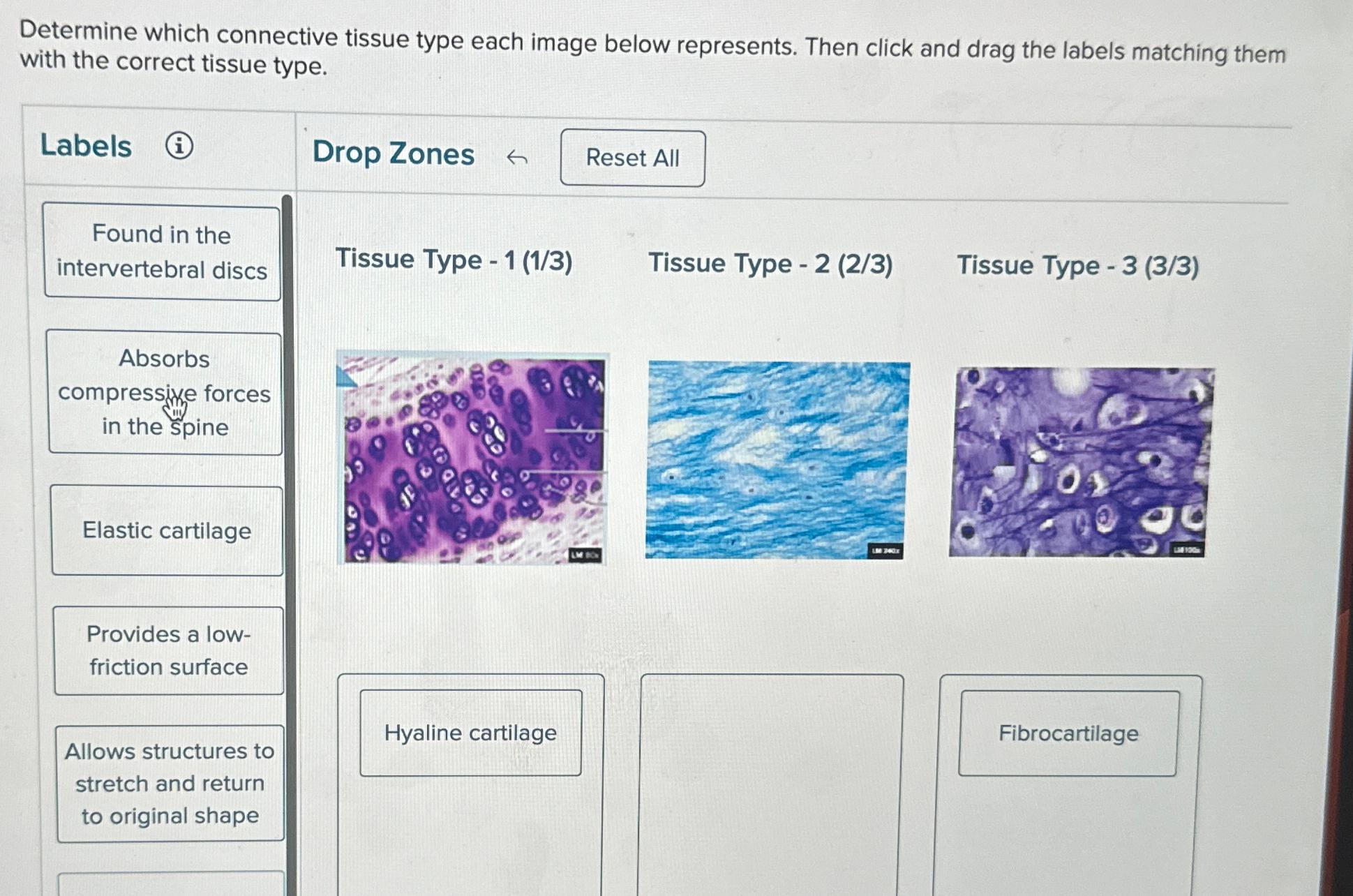Solved Determine which connective tissue type each image | Chegg.com