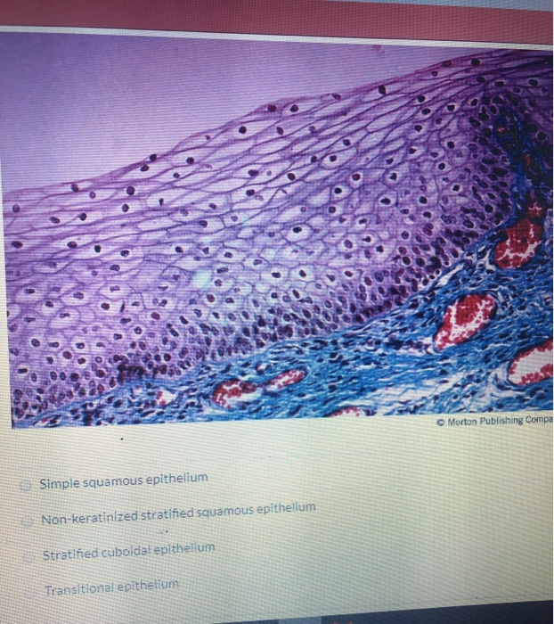 Solved Morton Publishing Compu Simple squamous epithelium | Chegg.com