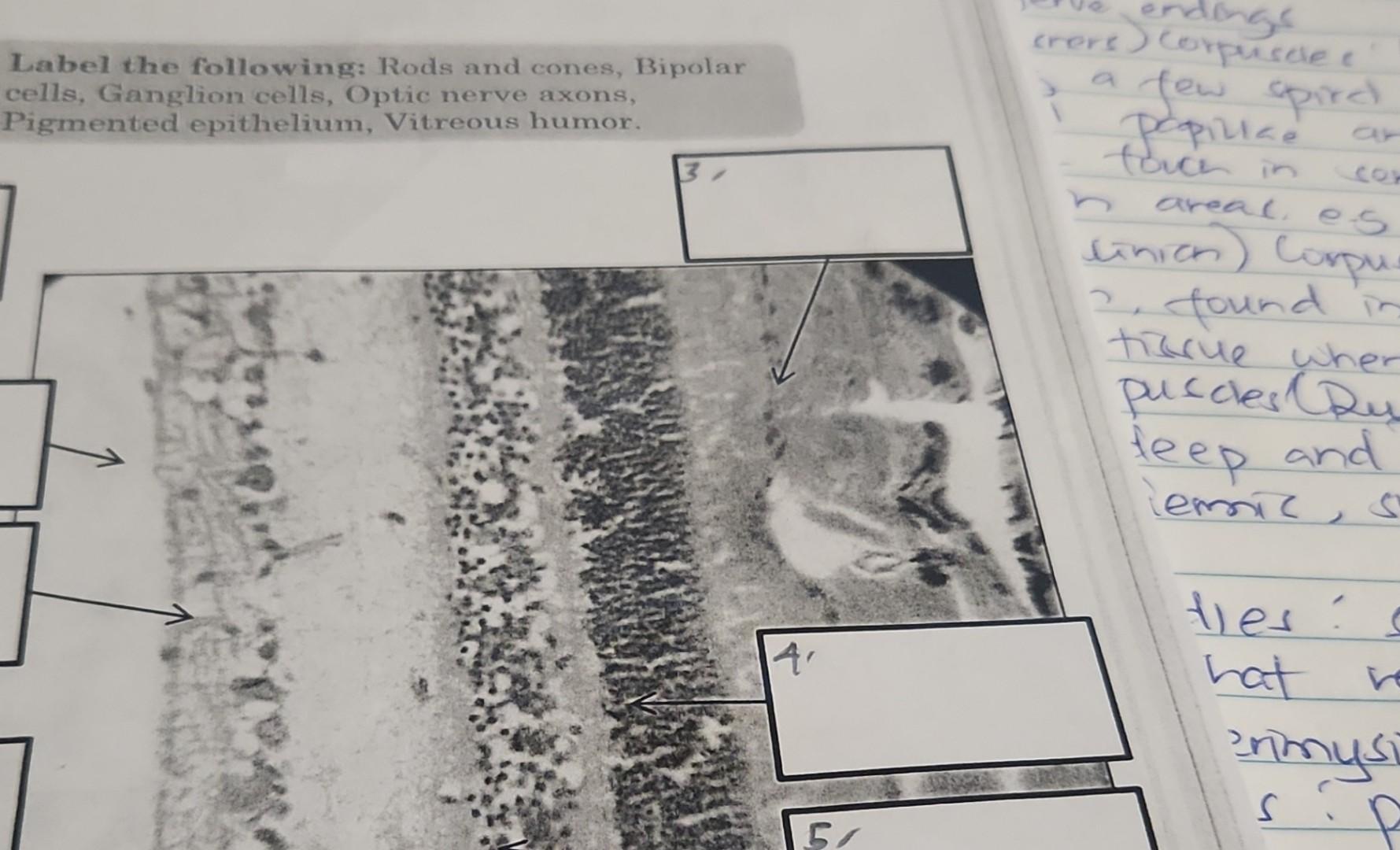 Label the following: Rods and cones, Bipolar cells, | Chegg.com