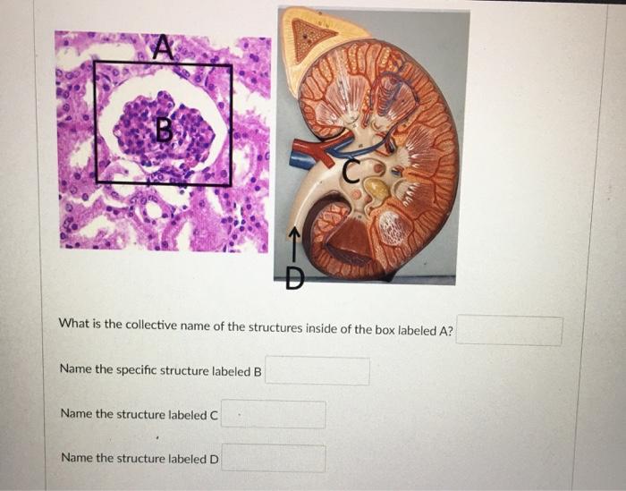 Solved С 3L B A. D Name the pouch-like structure labeled A | Chegg.com