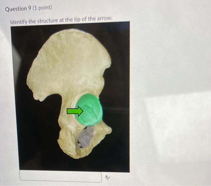 Solved Identify the structure at the tip of the arrow. | Chegg.com Solved Identify the structure at the tip of the arrow. | Chegg.com