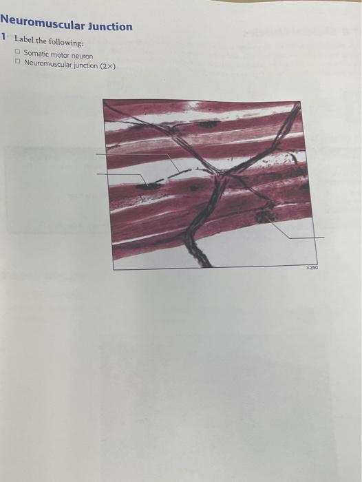 Solved Neuromuscular Junction 1 Label the following Somatic | Chegg.com