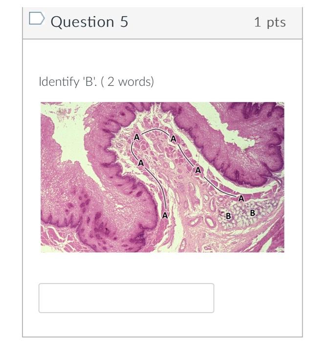 Solved Question 5 Identify B 2 Words 