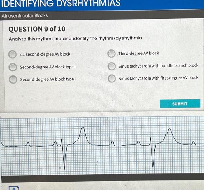 Solved Analyze this rhythm strip and identify the | Chegg.com