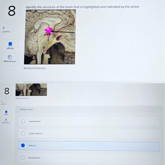 Solved Identify the structure of the brain that is | Chegg.com