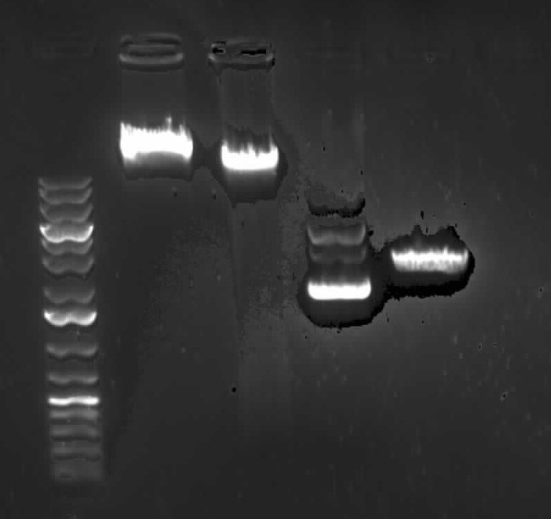 Help me interperate my gel electrophoreses results | Chegg.com