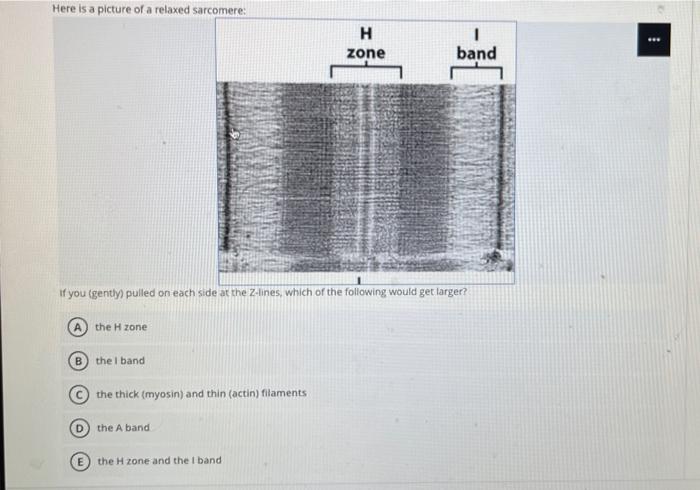 Solved Here is a picture of a relaxed sarcomere : H zone | Chegg.com
