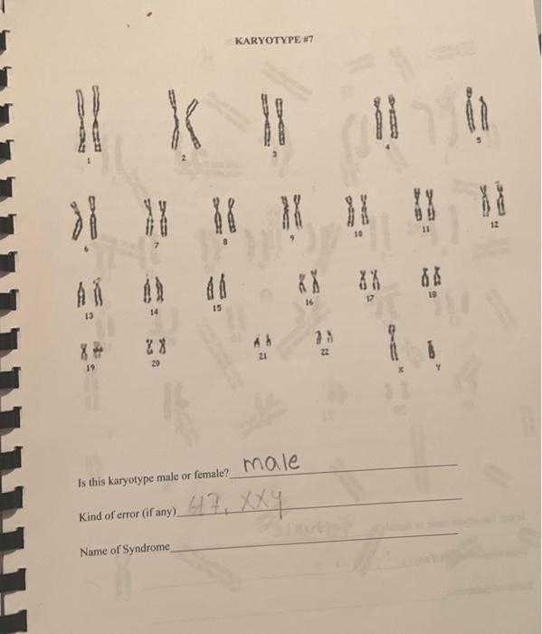 Solved \r\nIs this karyotype male or female? Kind of error | Chegg.com